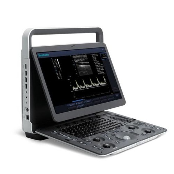 อัลตราซาวด์ E1 B/W Ultrasound