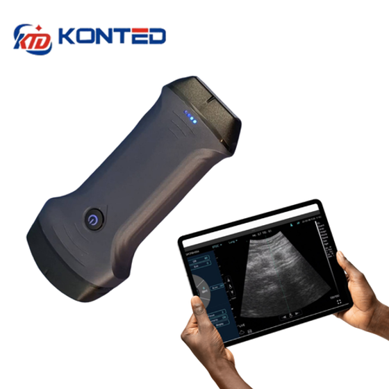 อัลตราซาวด์ Ultrasound ยี่ห้อ KONTED รุ่น C10 (Wireless prope)