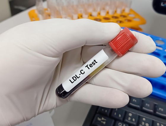 ผมรู้มาว่า ถ้าไขมันเลว (LDL-C) ลดลงความดันโลหิตก็จะลดลงด้วย GABA ช่วย ...