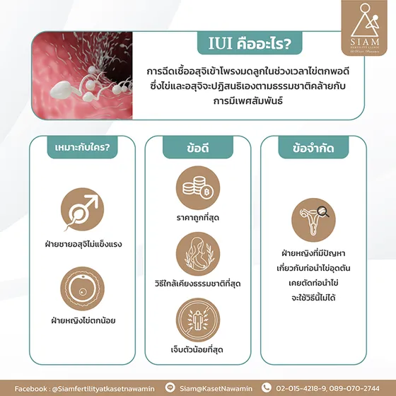 IUI