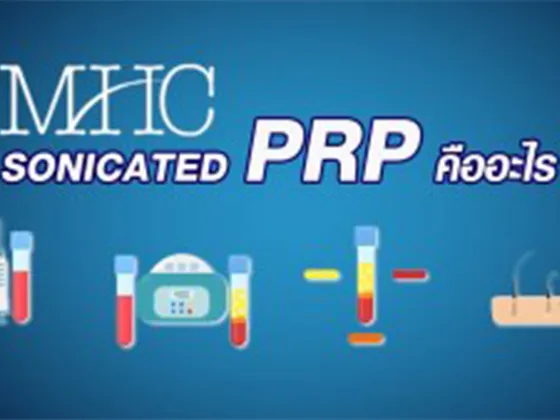 Sonicated PRP