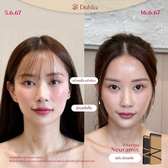 โปรแกรม Filler